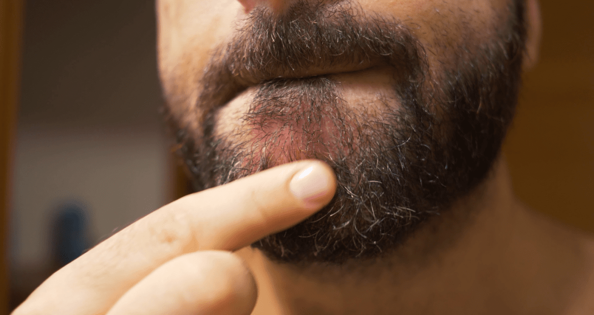 Why Does My Beard Itch | Beard Care Guide | Seraphic Skincare